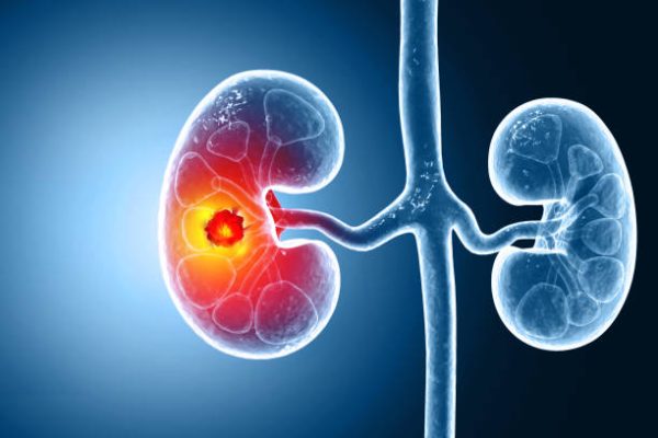 Paediatric kidney diseases – RENMED CLINIC